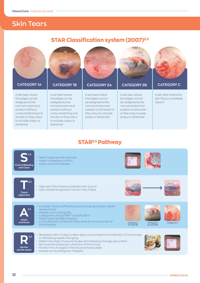 Skin Tear Classification