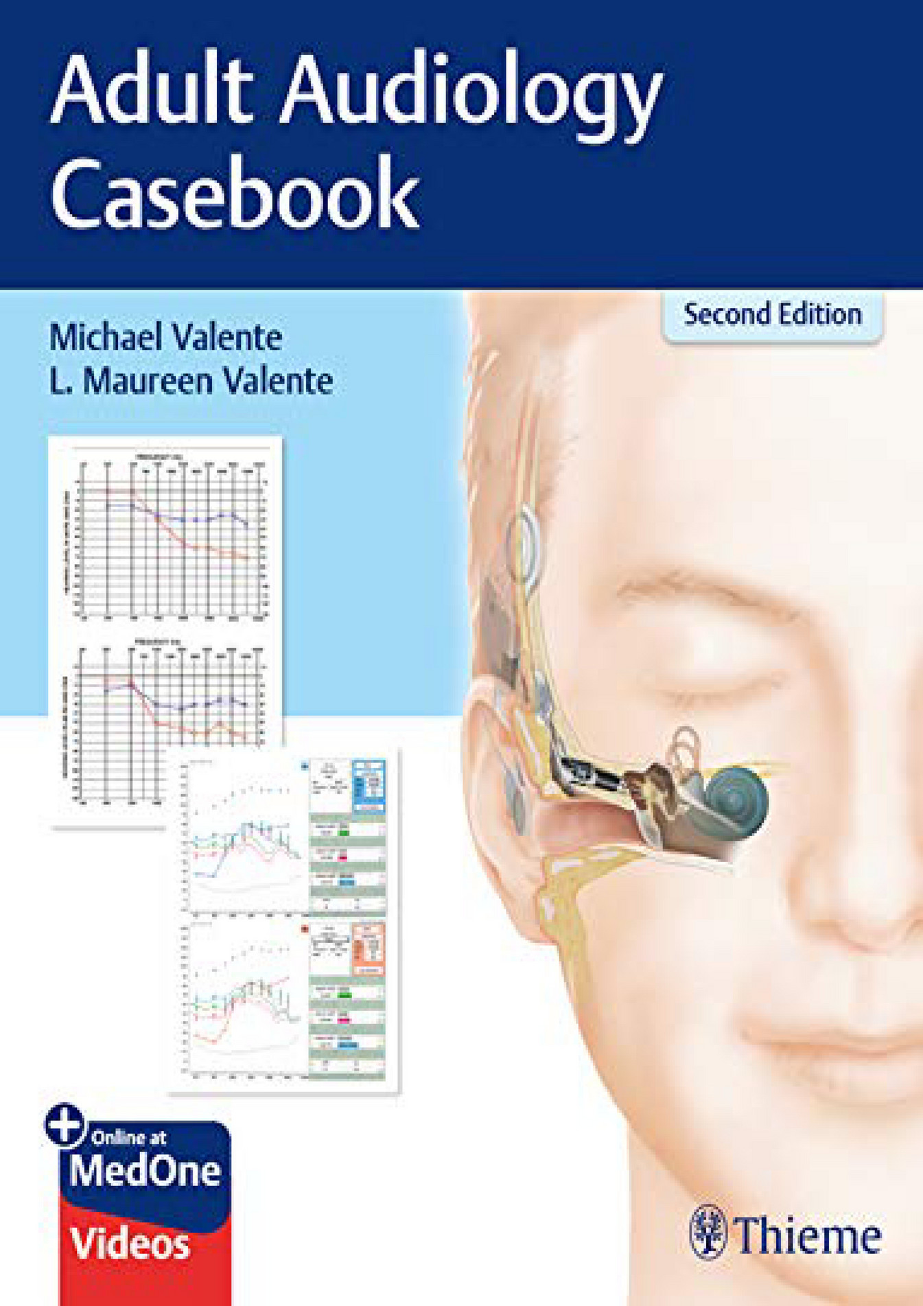 eBOOK - EBOOK Adult Audiology Casebook - Page 1 - Created with Publitas.com
