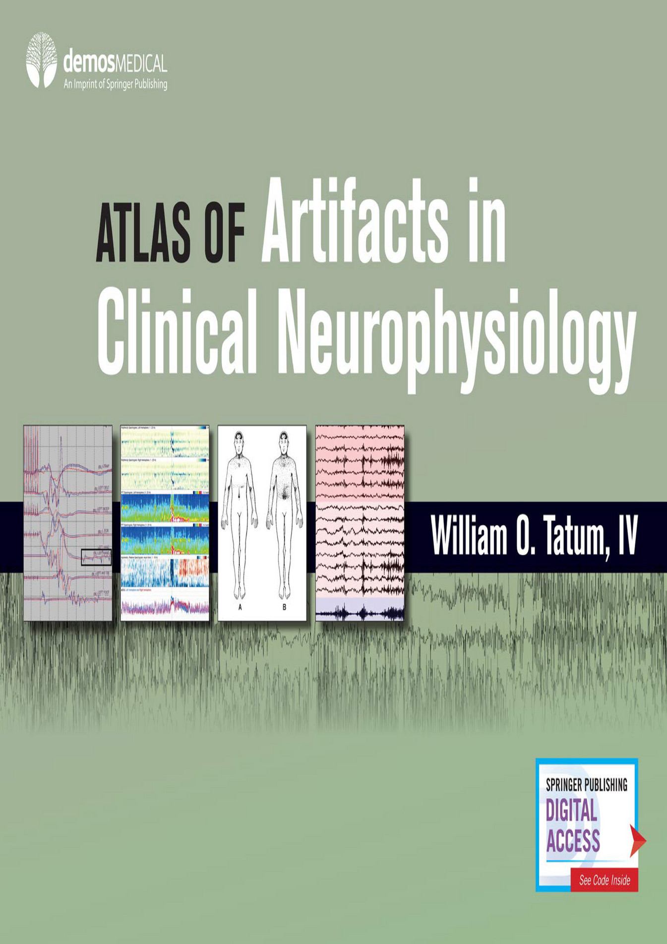 weyant - DOWNLOAD Atlas of Artifacts in Clinical Neurophysiology - Page ...
