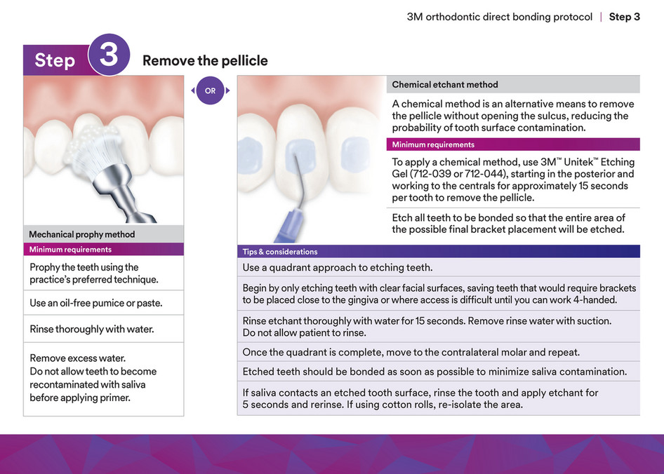 Ortho-Trends - Bonding protocol Flash free - Page 3 - Created with ...