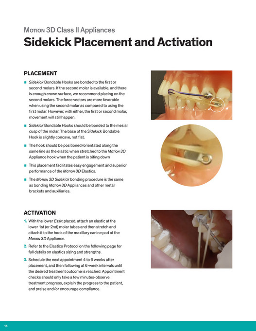 Ortho-Trends - Quick Start Guide Carriere Motion 3D - Page 14-15 ...