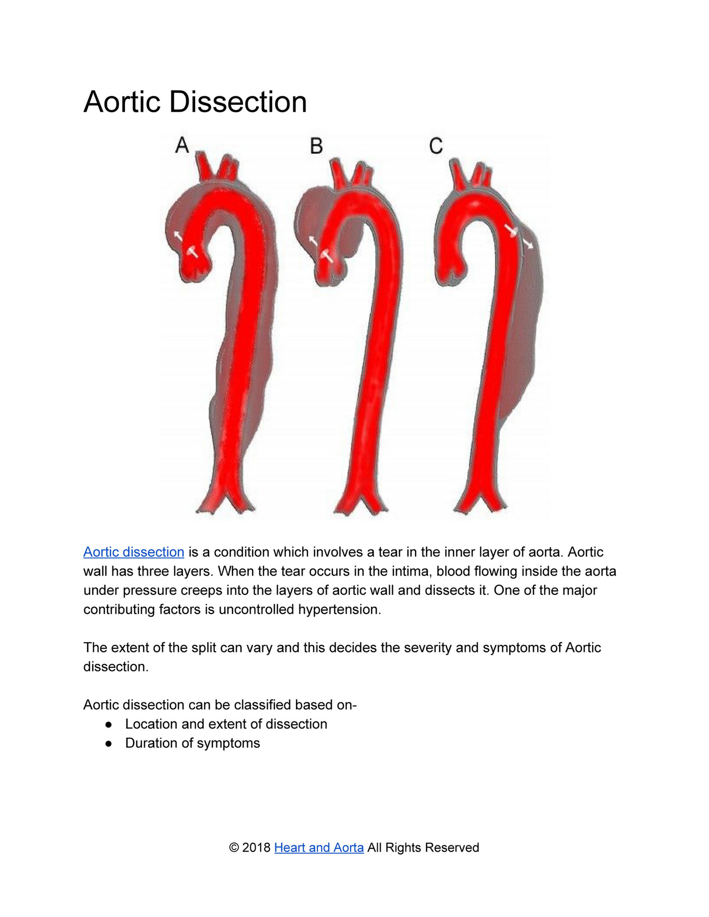 Heart and Aorta - Aortic Dissection_ An Overview - Page 1 - Created ...