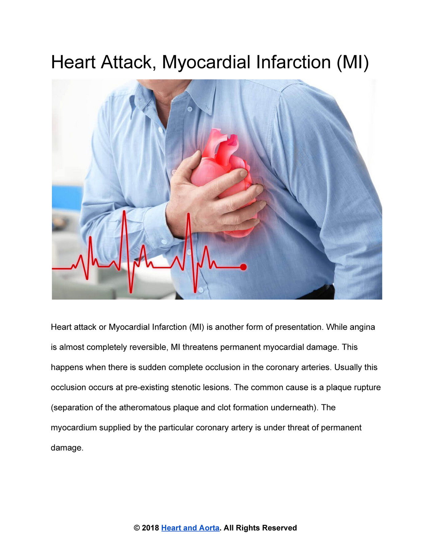 Heart and Aorta - Heart Attack or Myocardial Infarction (MI) - Page 1 ...